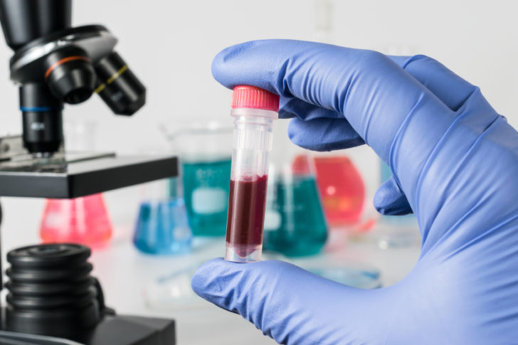 Blood test developed that can screen and locate cancers - The ...