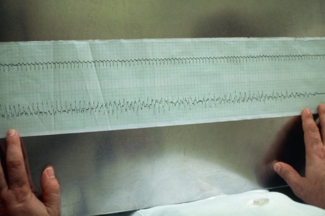 I’ve seen first-hand that ECT is a dignified treatment, so why is there ...