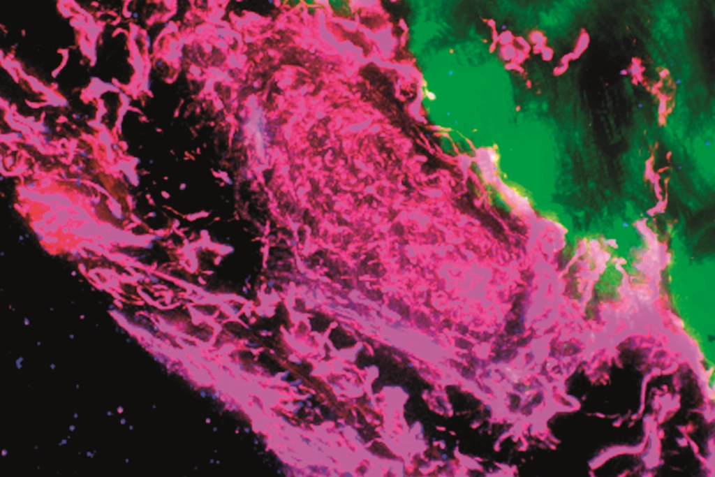 Pathophysiology and management of heart failure - The Pharmaceutical ...