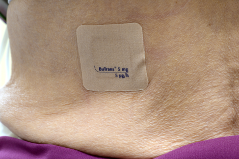 Delayed market entry for generic buprenorphine patches could have cost ...