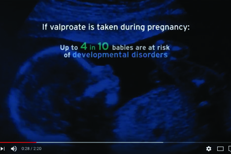 New video explains the risks of valproate in female patients - The ...