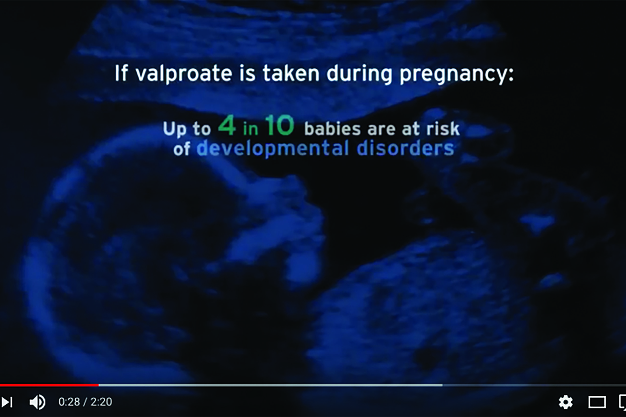 New video explains the risks of valproate in female patients - The ...