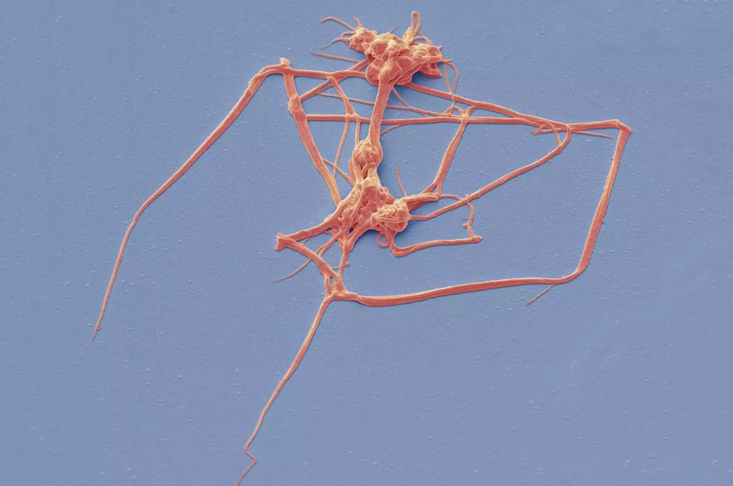 Heparin-induced thrombocytopenia - The Pharmaceutical Journal