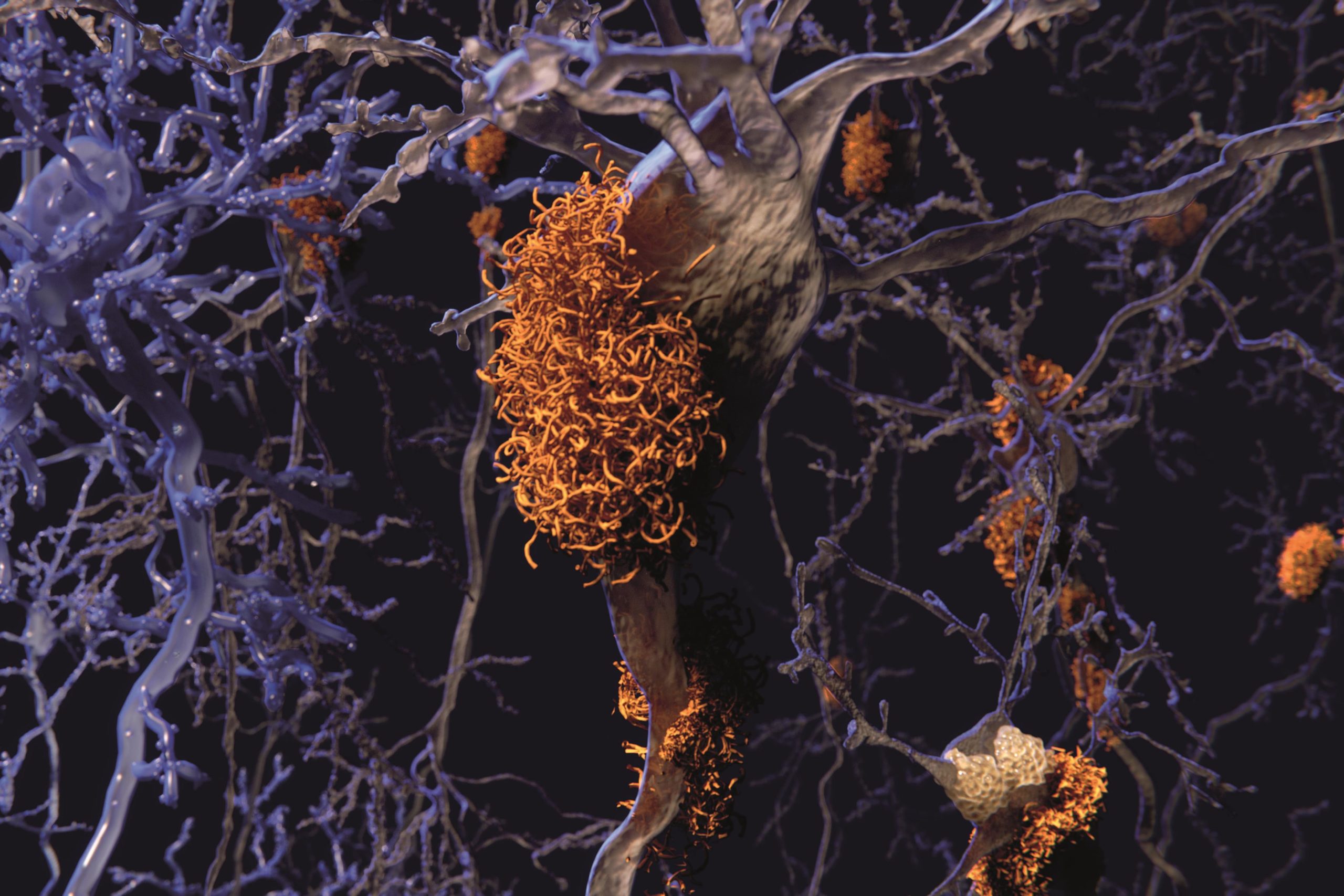 ‘Neurostatin’ prevents Alzheimer's-related amyloid formation - The ...