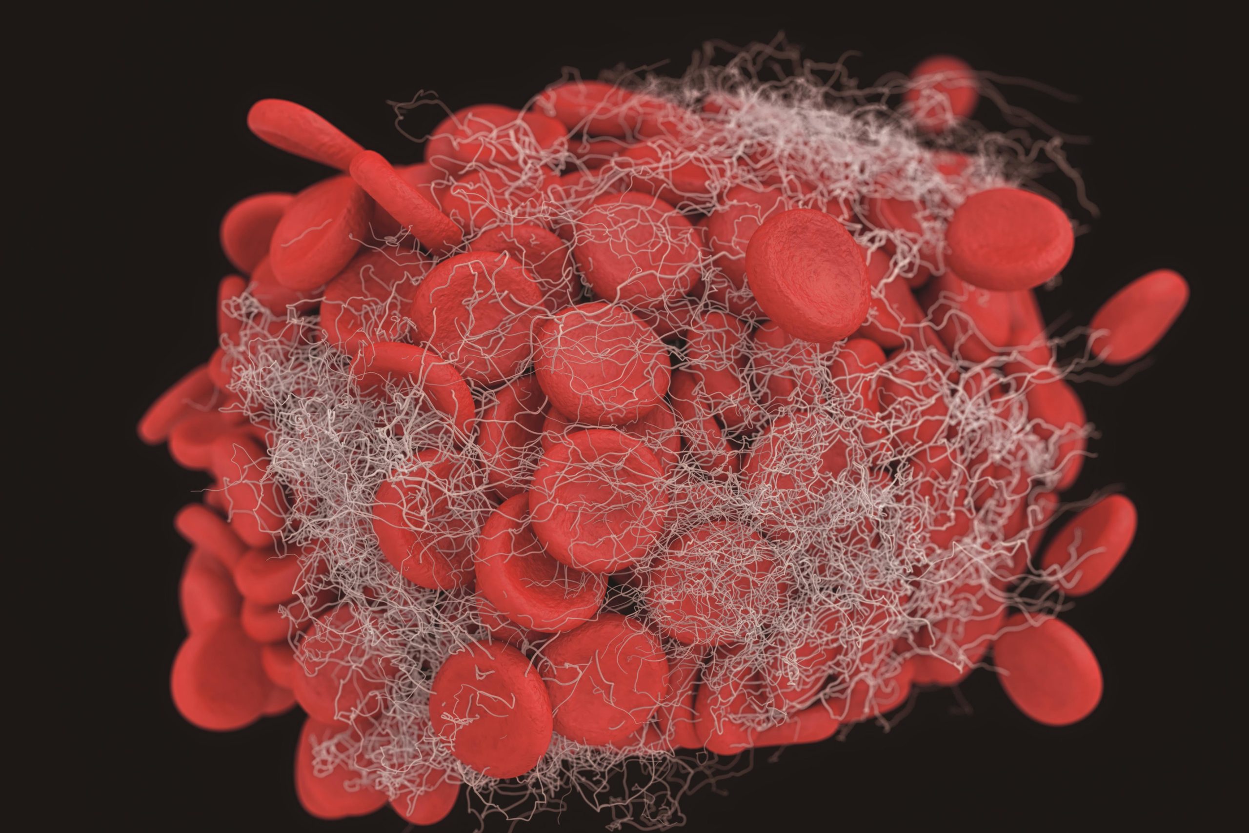 Apixaban more effective than warfarin regardless of polypharmacy - The ...
