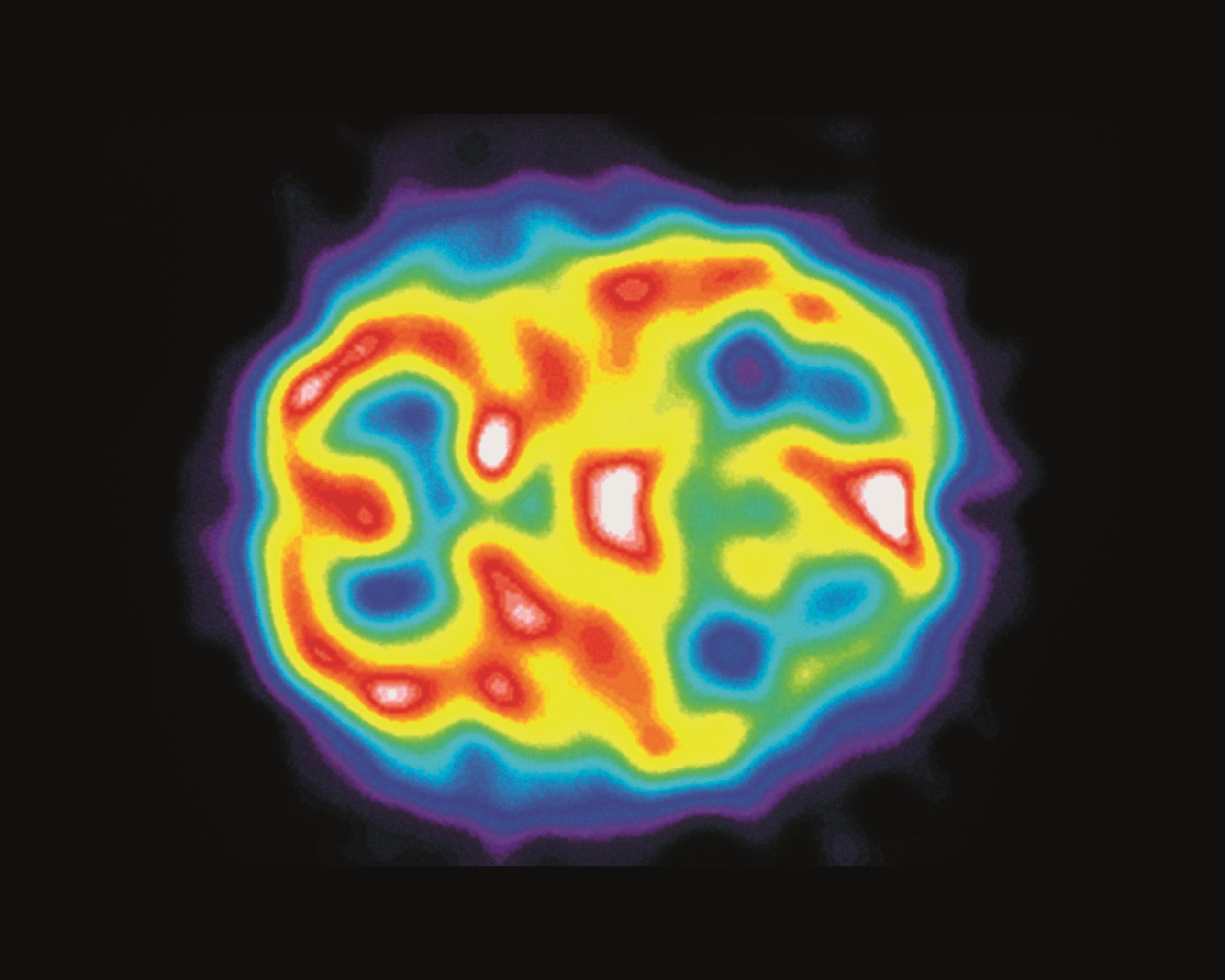Triptan interactions - The Pharmaceutical Journal