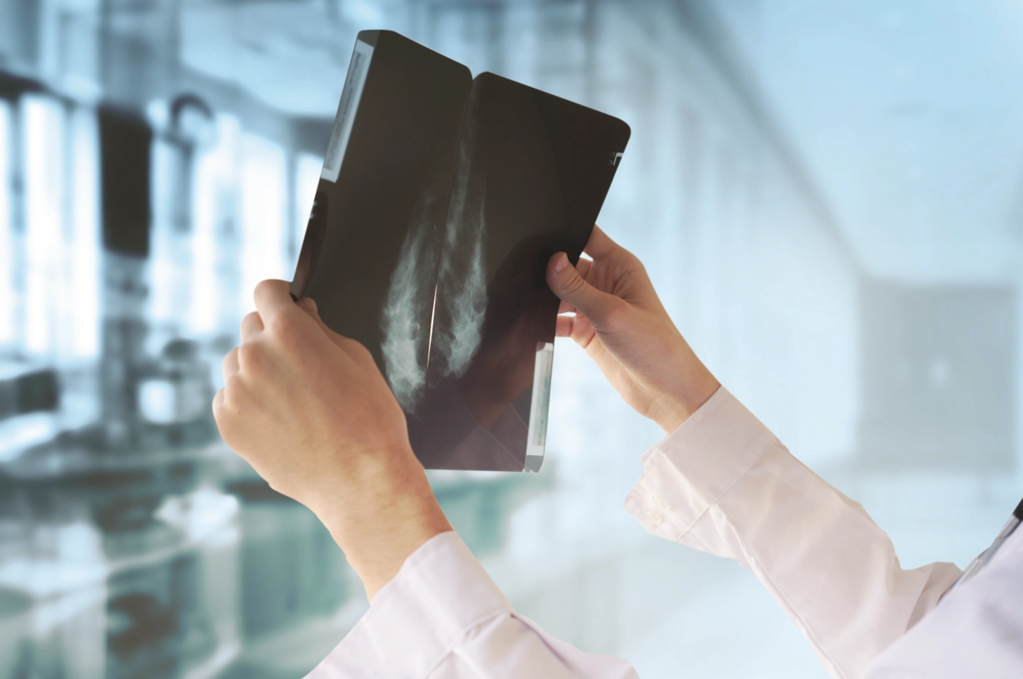Palbociclib slows tumour growth in early breast cancer - The ...