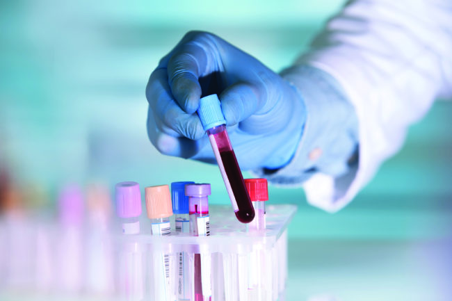 Blood test for cancer on the horizon - The Pharmaceutical Journal