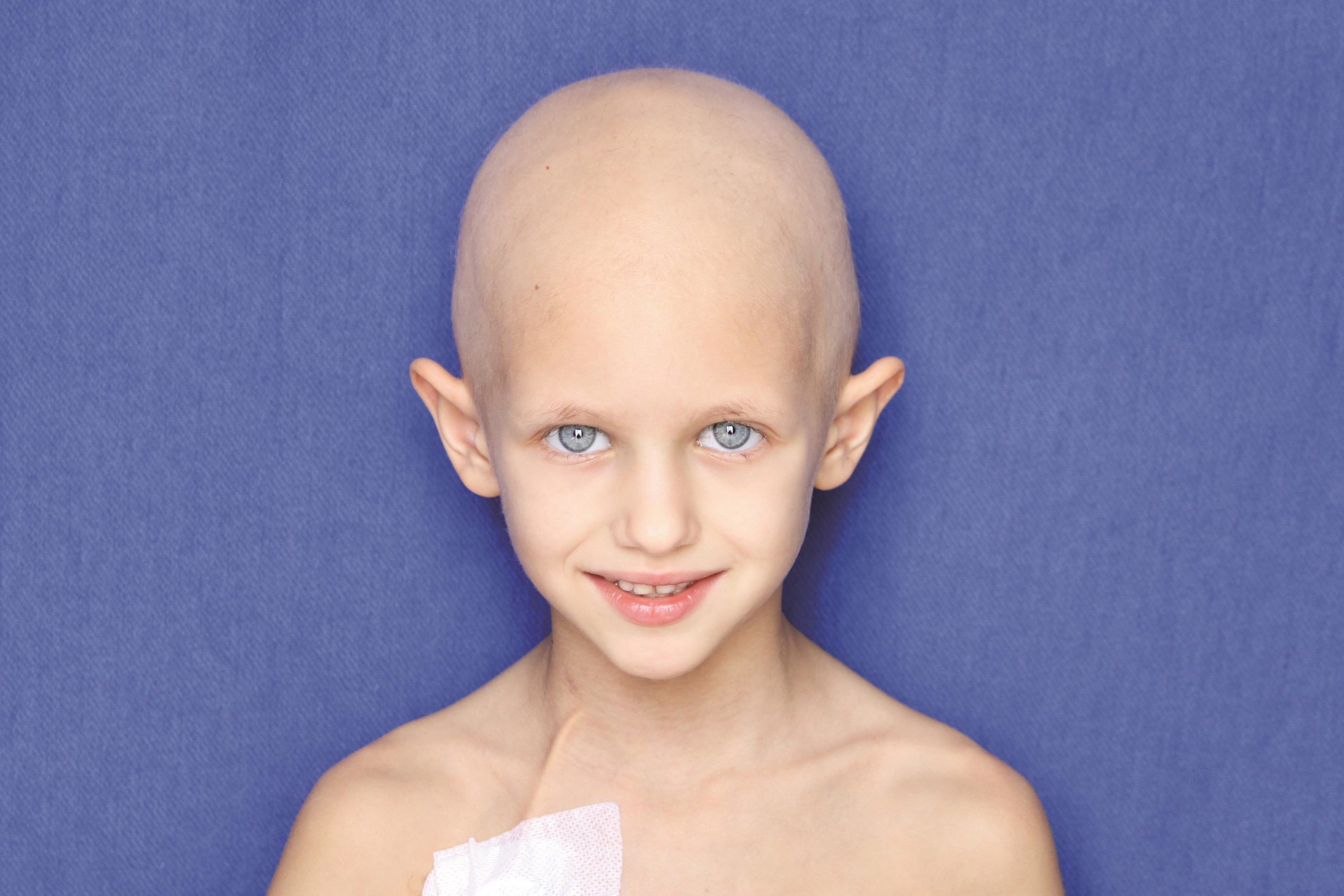 Childhood chemotherapy has modest effect on female fertility - The ...