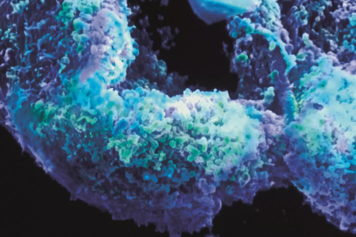 Treating bacterial sexually transmitted infections - The Pharmaceutical ...