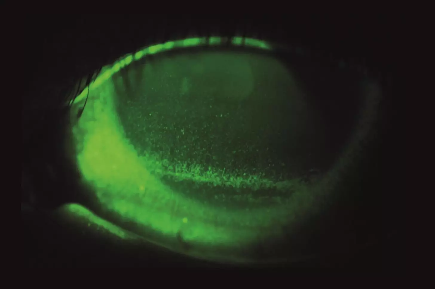 Identification of dry eye conditions in community pharmacy - The ...