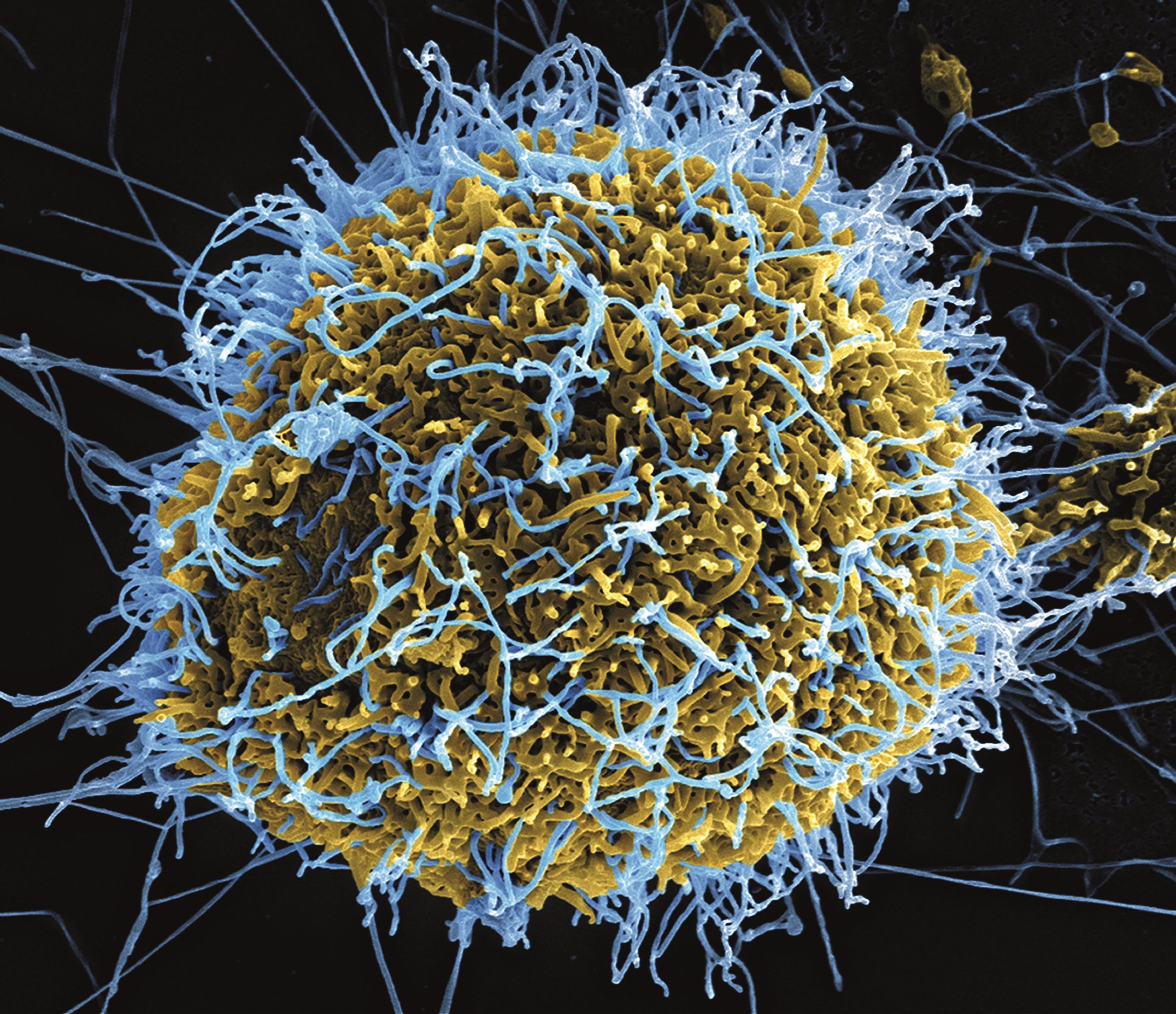 Researchers highlight possible Ebola drug target - The Pharmaceutical ...