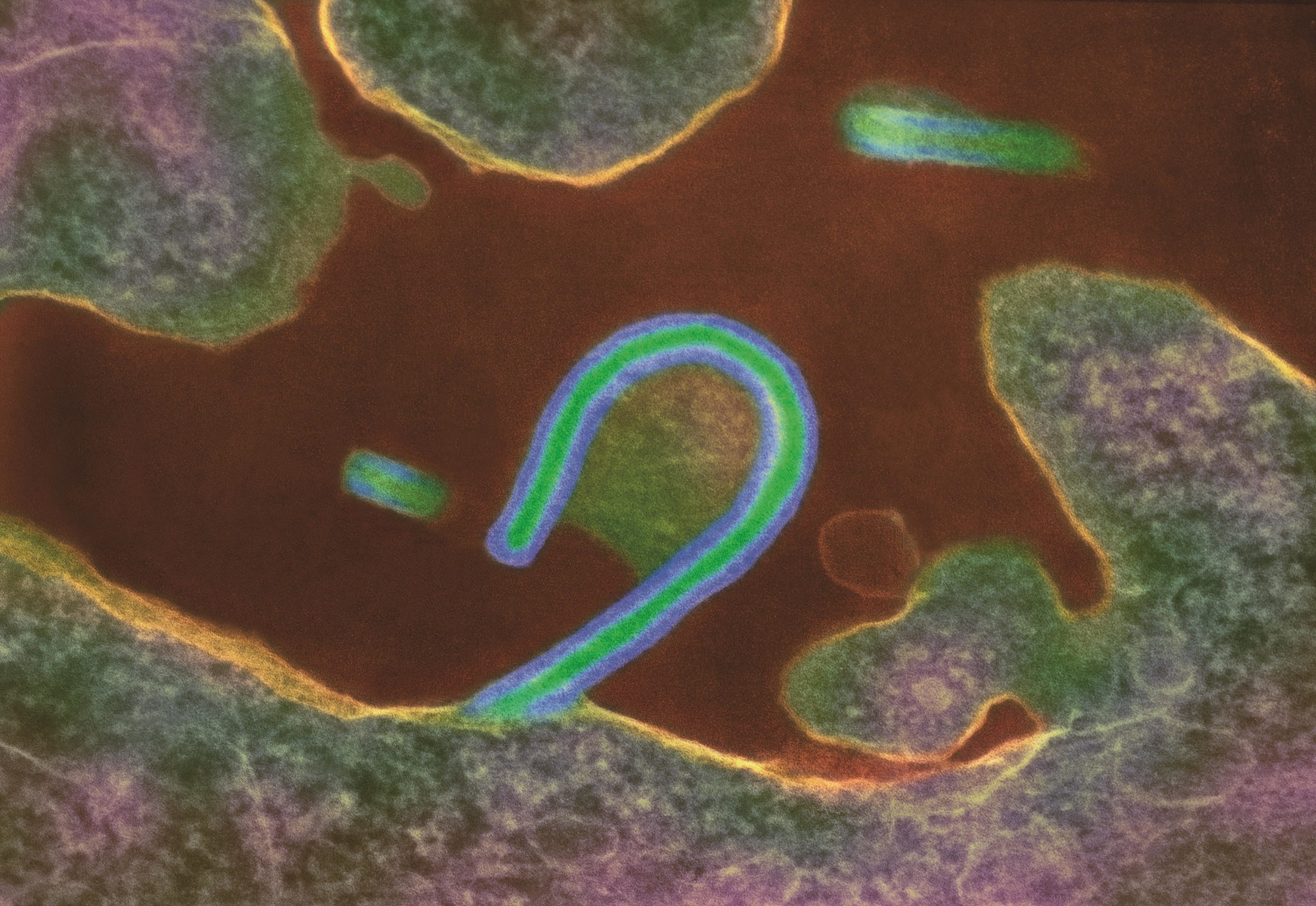 Viral cell entry holds clue to effective treatment of Ebola - The ...