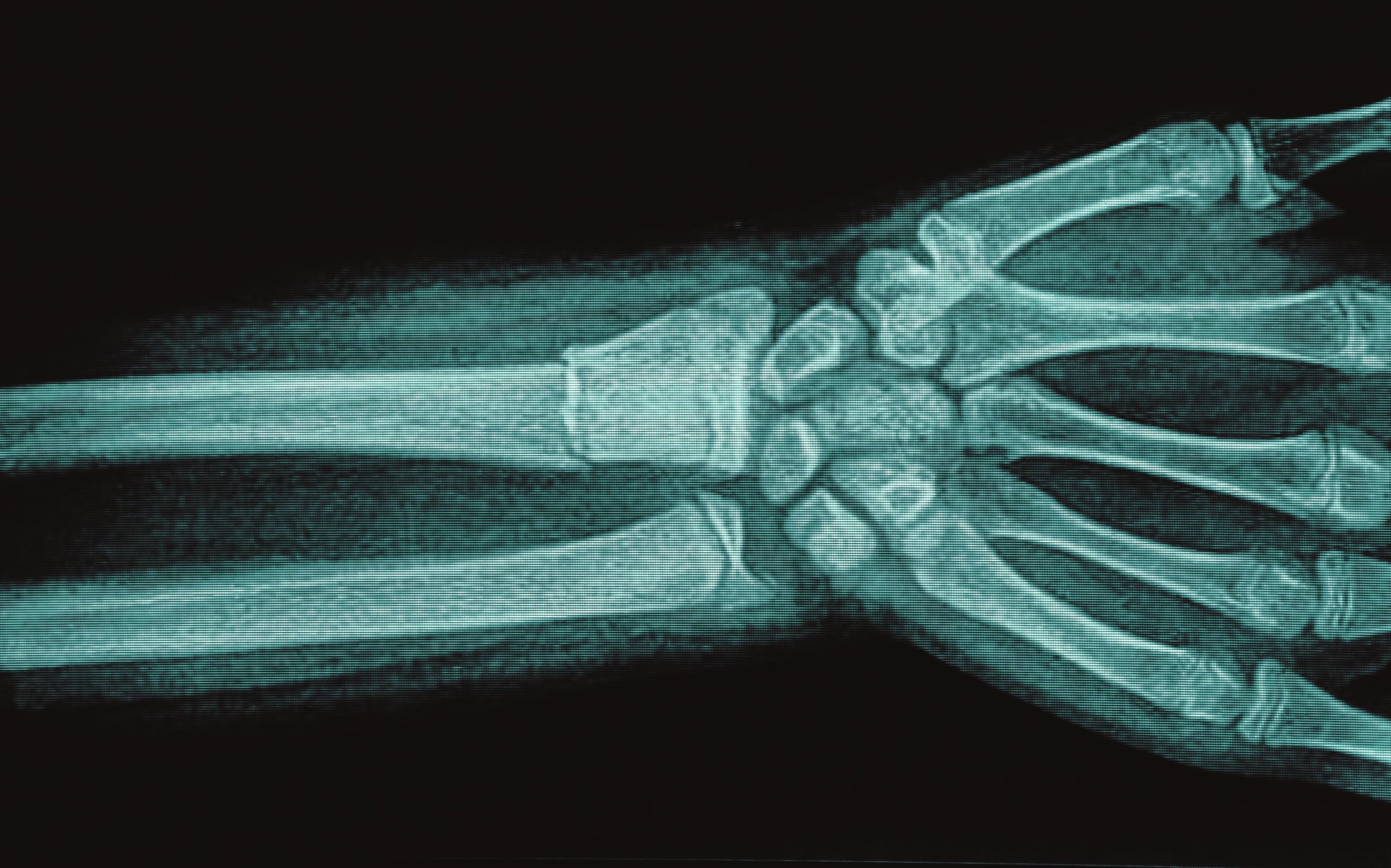 Study provides insight into why PPI users benefit from calcium ...