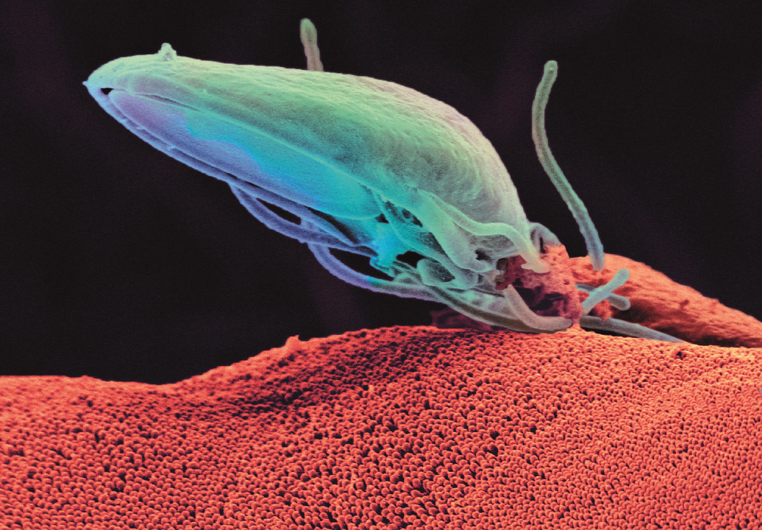 Assessing suspected food poisoning cases in the UK - The Pharmaceutical ...