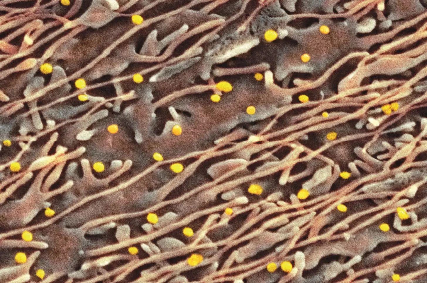 EU approval of AbbVie’s hepatitis C combination therapies challenges ...