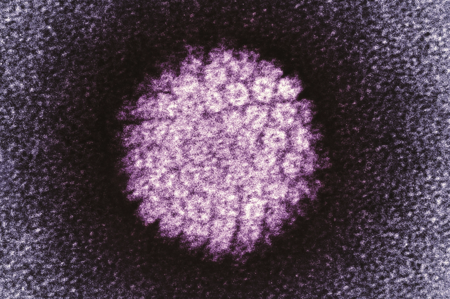 High-risk HPV infection linked to increased risk of cardiovascular ...