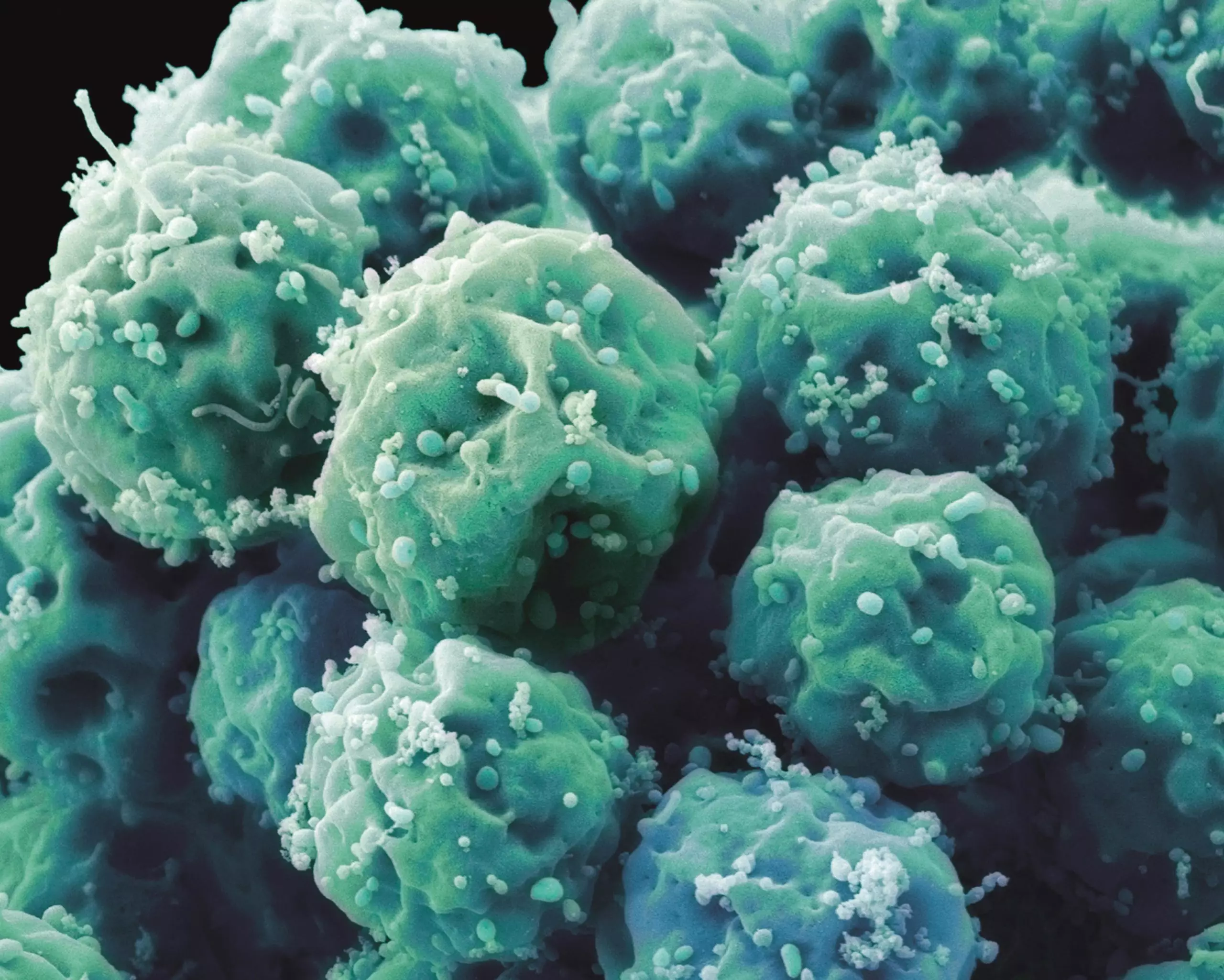 Scientists develop human insulin-producing cells to treat type 1 ...