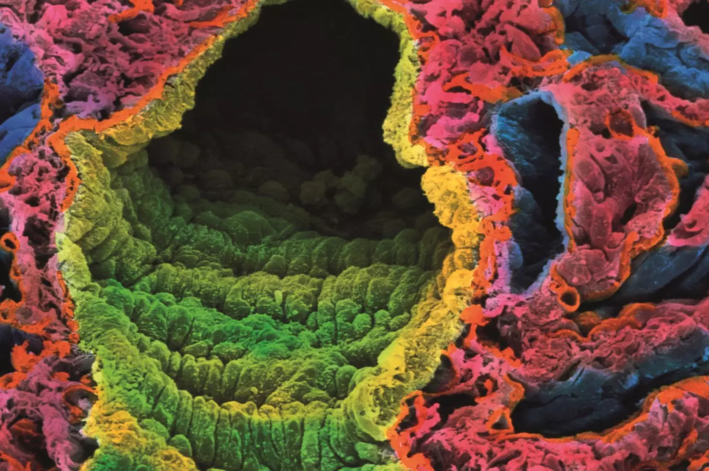 Inhaled corticosteroids: managing side effects - The Pharmaceutical Journal