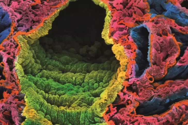 Inhaled corticosteroids: managing side effects - The Pharmaceutical Journal