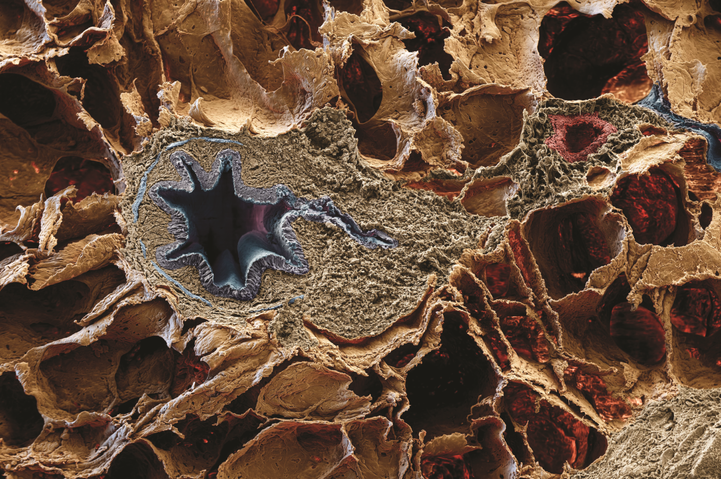 Diagnosis and management of hospital-acquired pneumonia in older adults ...