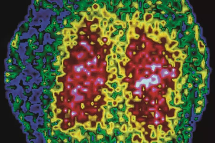 Asthma: pathophysiology, causes and diagnosis - The Pharmaceutical Journal