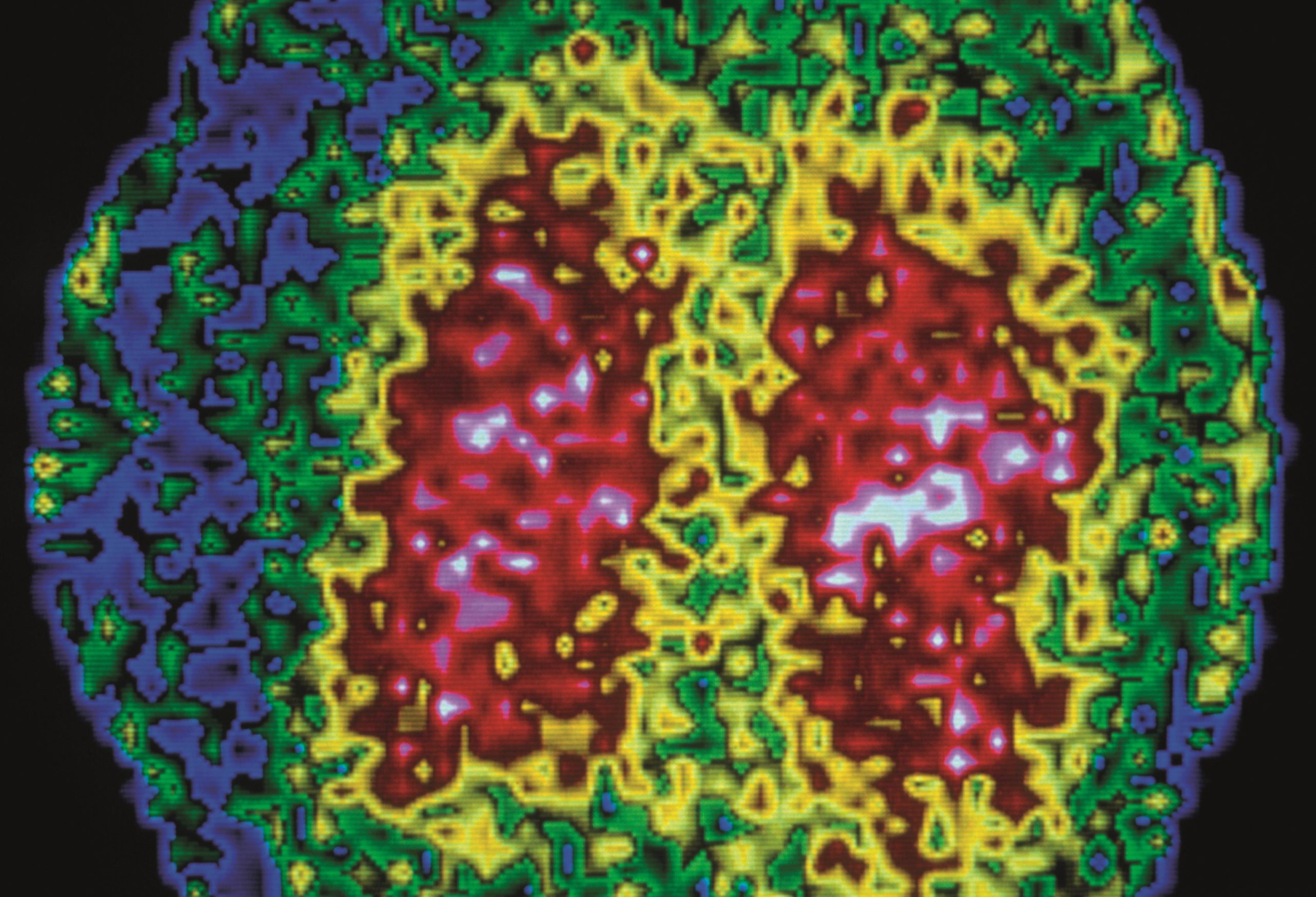 Asthma: pathophysiology, causes and diagnosis - The Pharmaceutical Journal