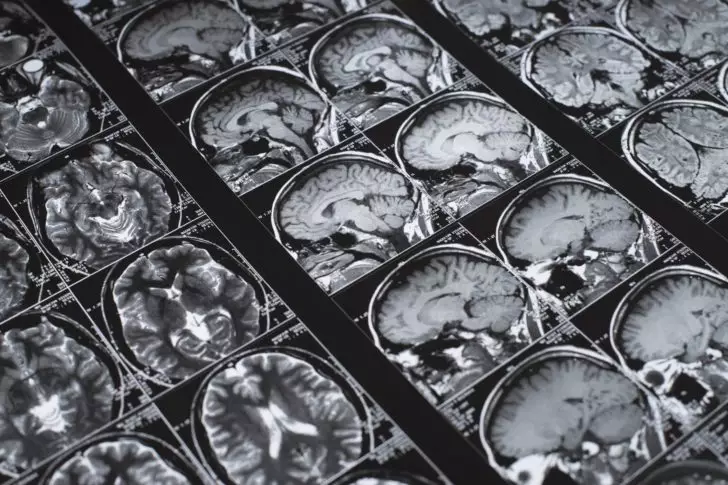 Scientists use crowdfunding to boost research into LSD effects on the ...