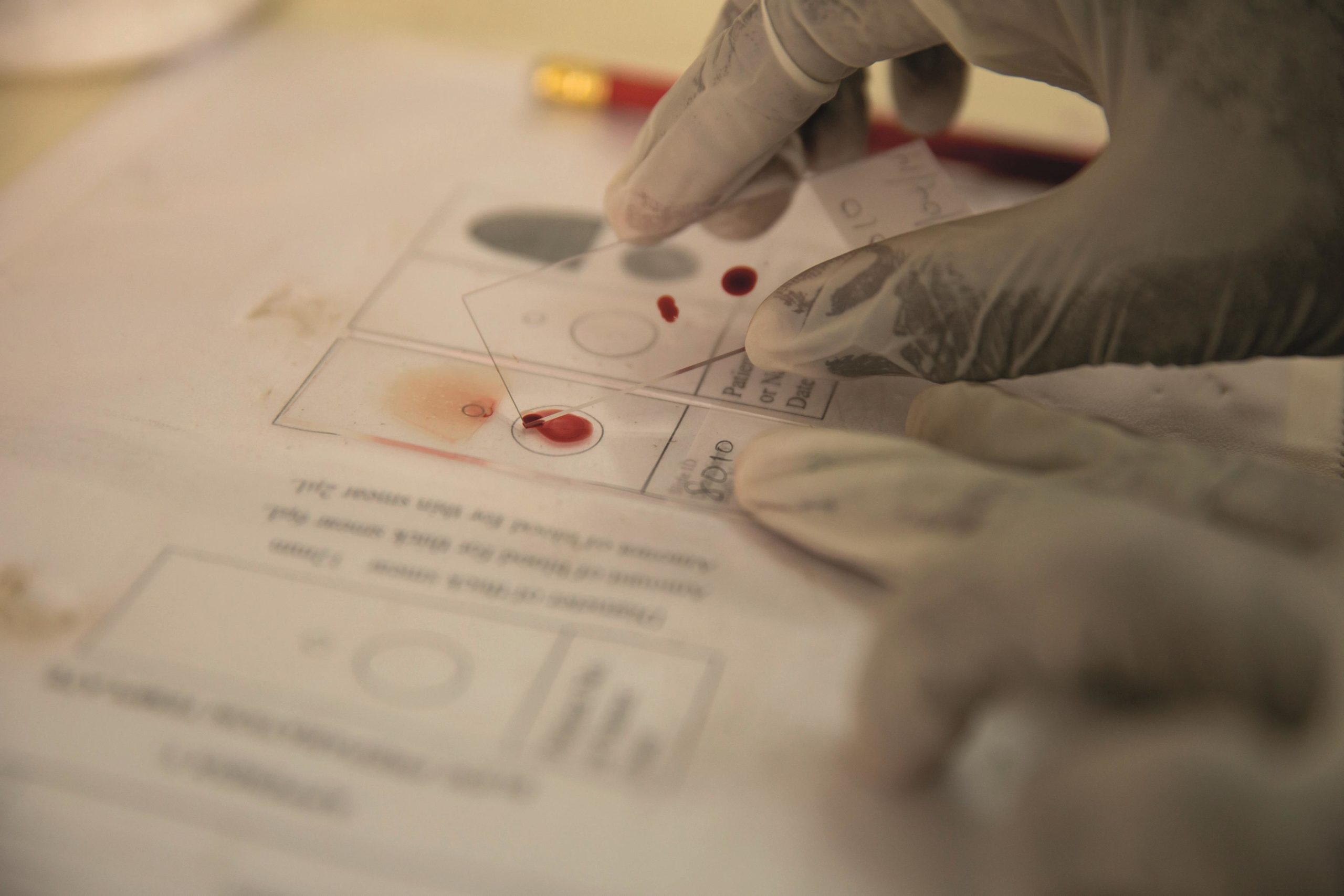 First malaria vaccine receives positive scientific opinion from EMA ...