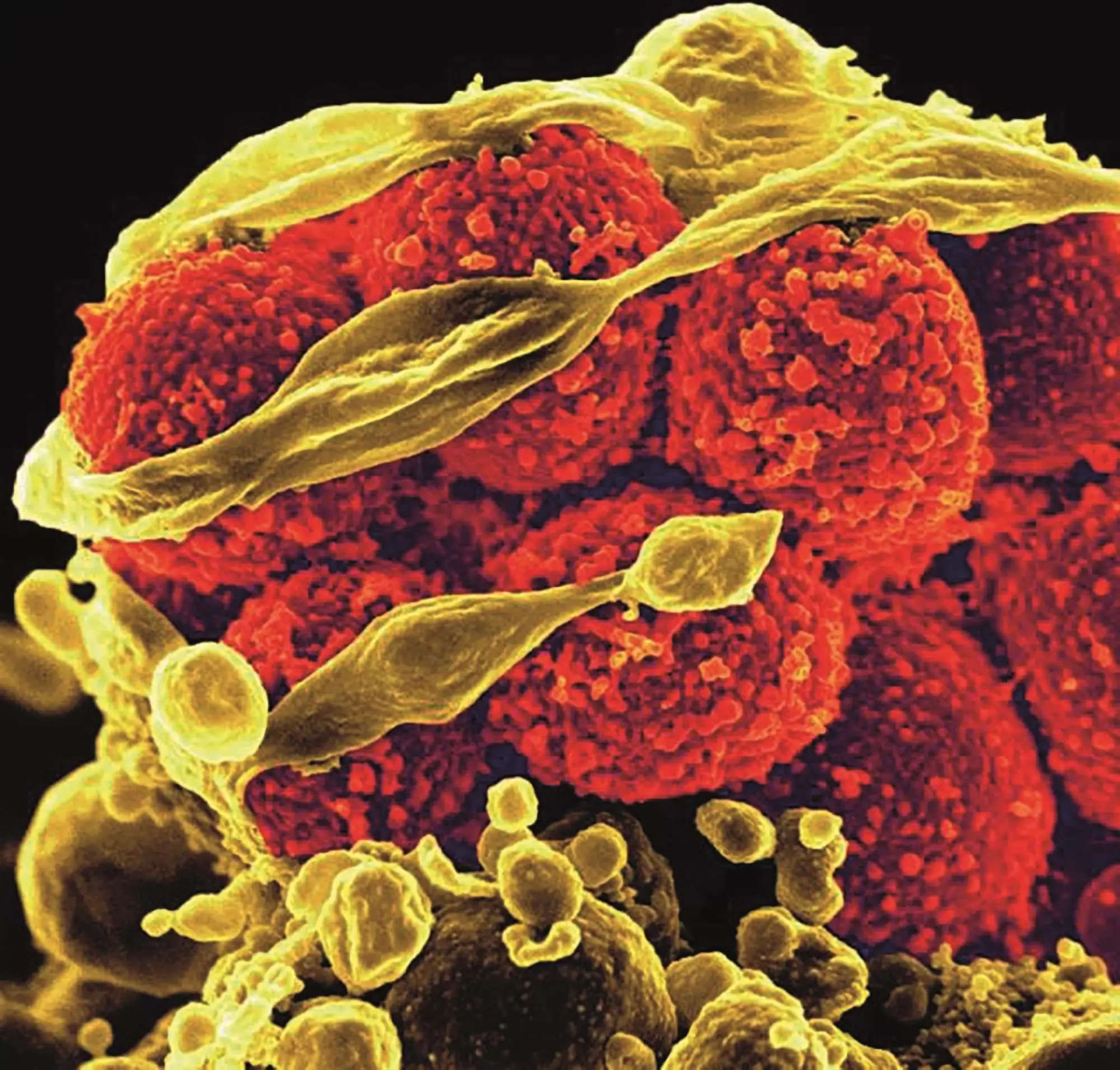 Beta-lactam antibiotics can make MRSA infection worse - The ...