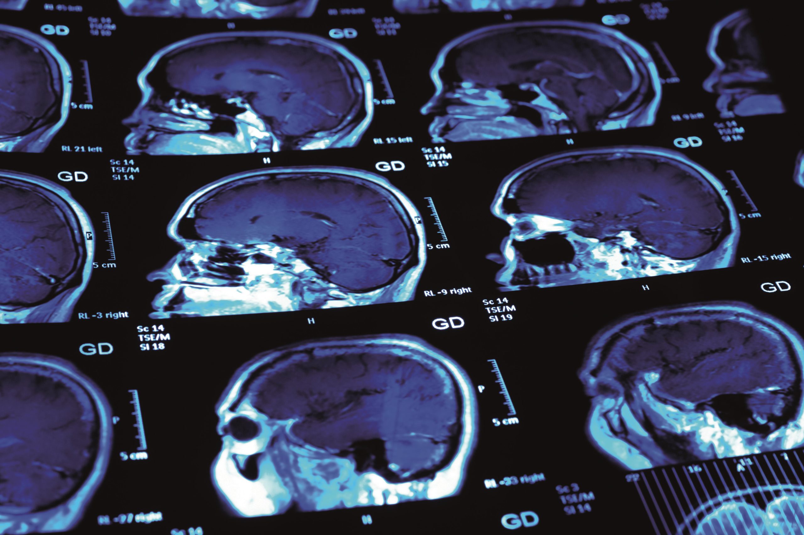 Researchers show how MRI data can help predict drug efficacy - The ...