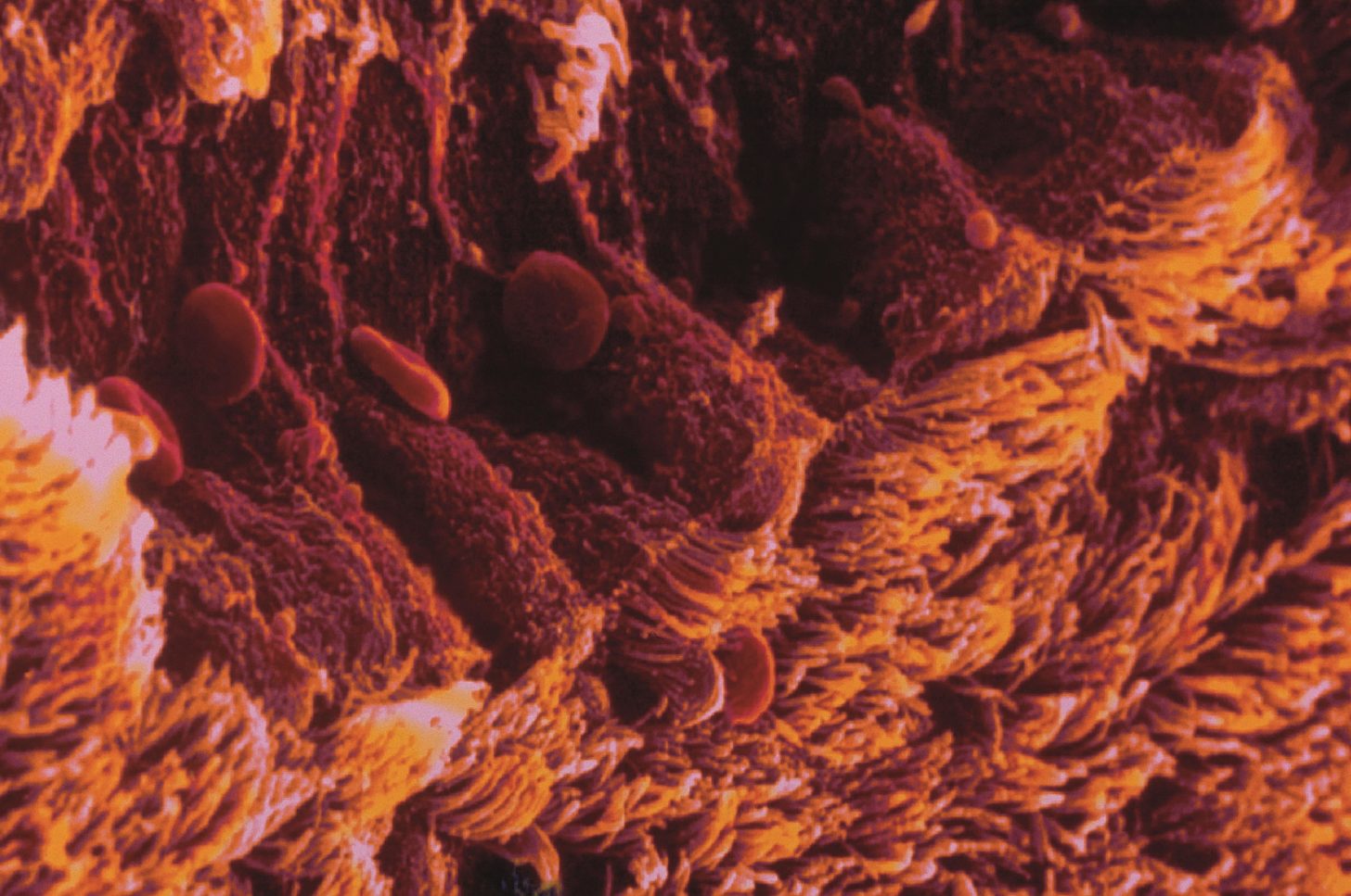 Researchers identify biomarkers for corticosteroid asthma response ...