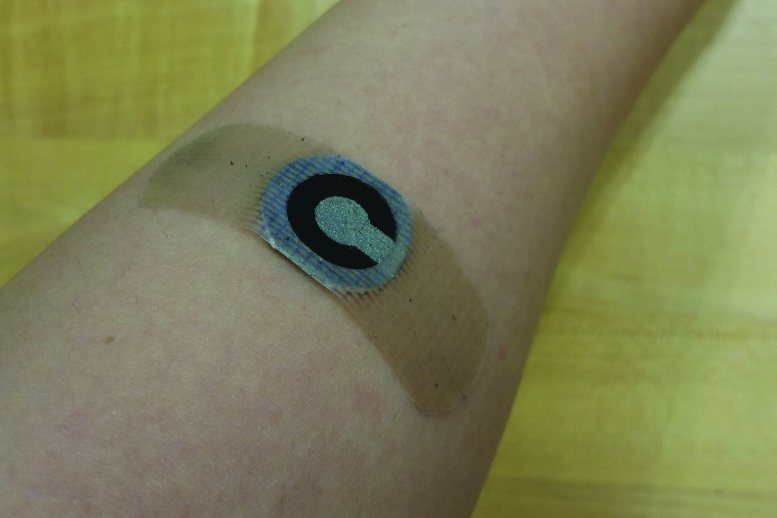 Non-invasive glucose monitoring for people with diabetes - The ...
