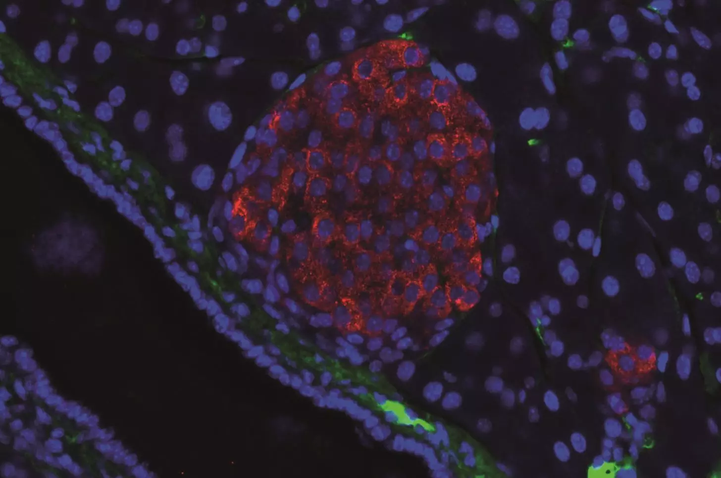Researchers use denosumab to stimulate beta cell proliferation - The ...
