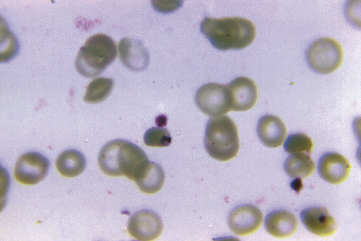 African parasite shows signs of resistance to widely used malaria ...