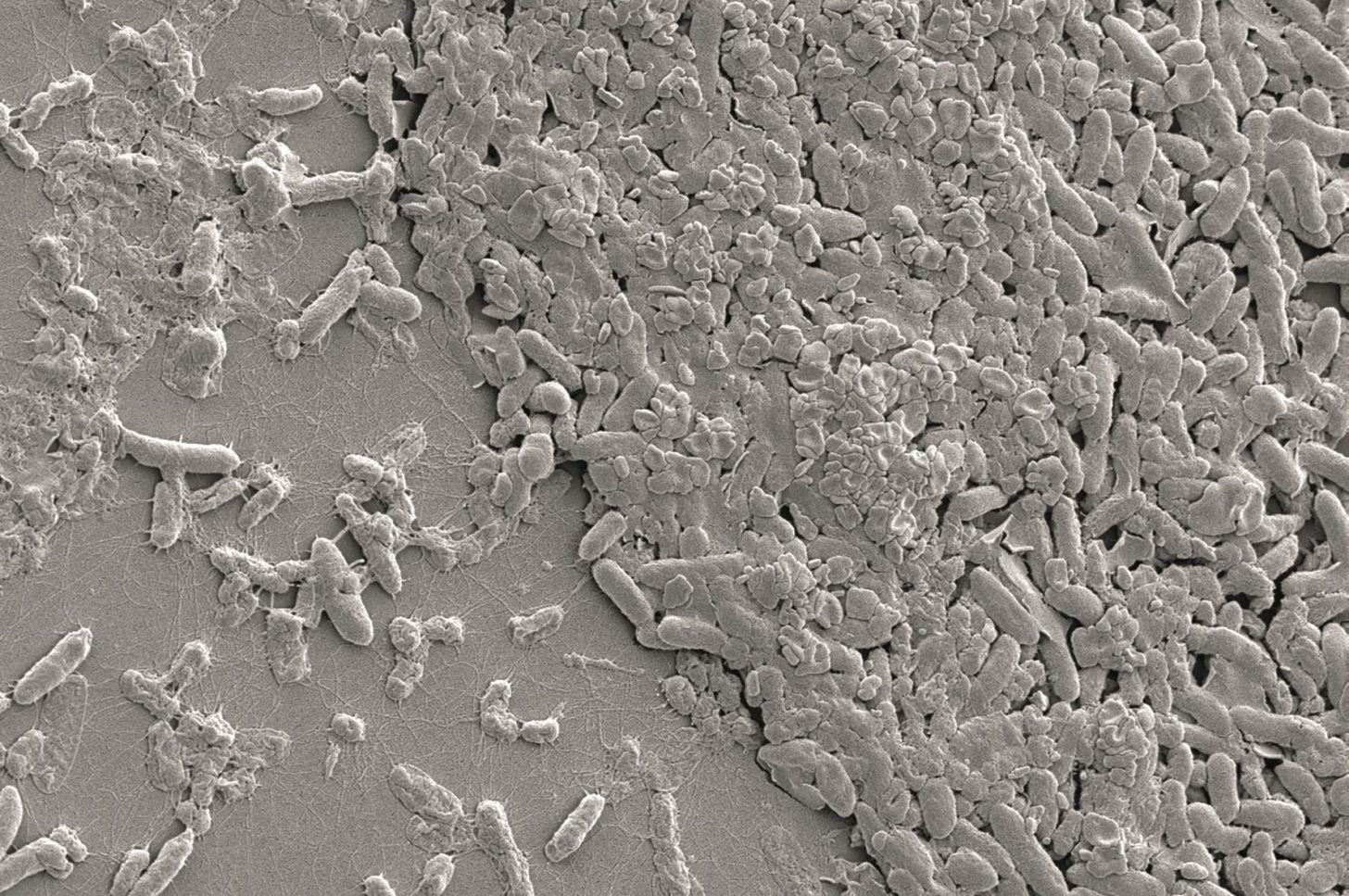 Antibacterial hydrogel could influence development of medical implants ...