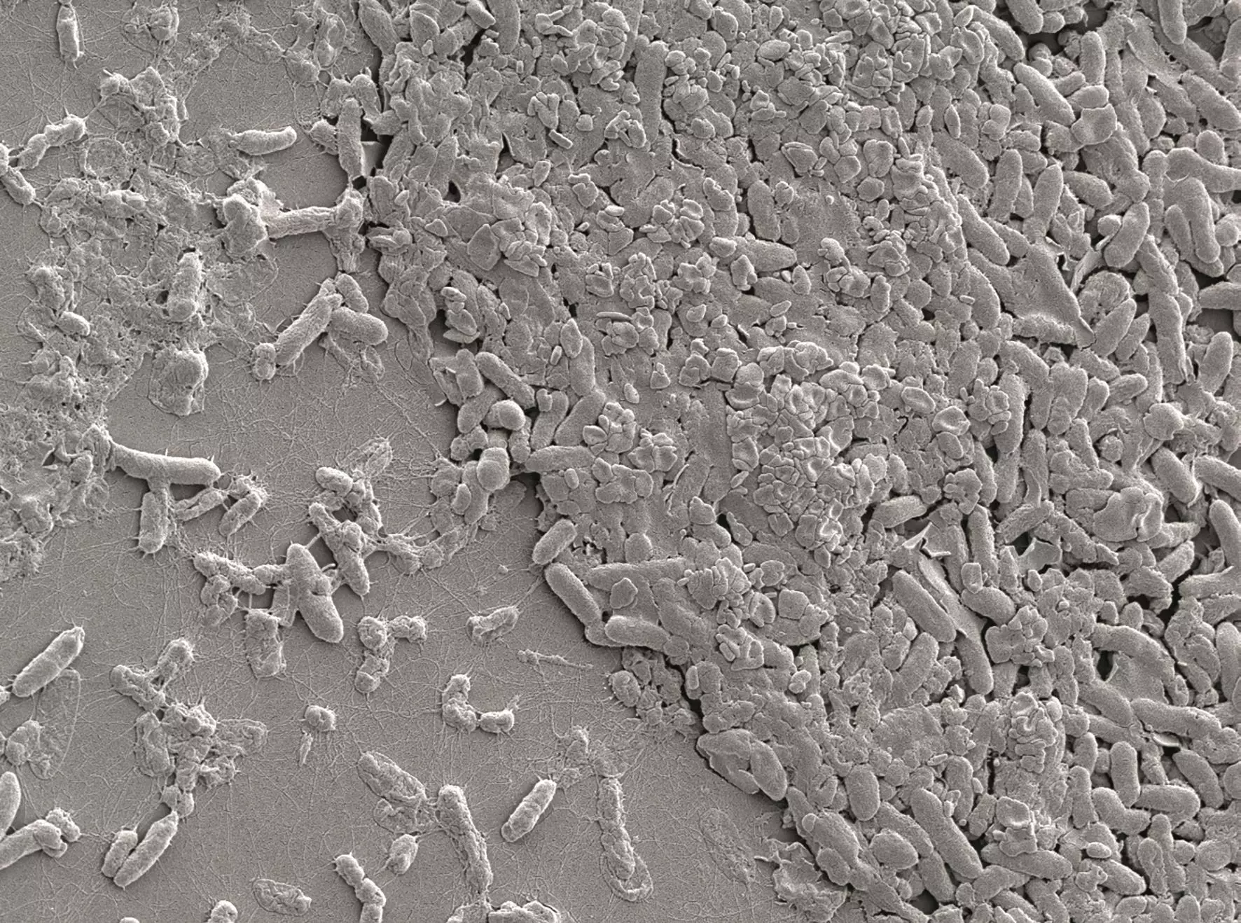 Antibacterial hydrogel could influence development of medical implants ...