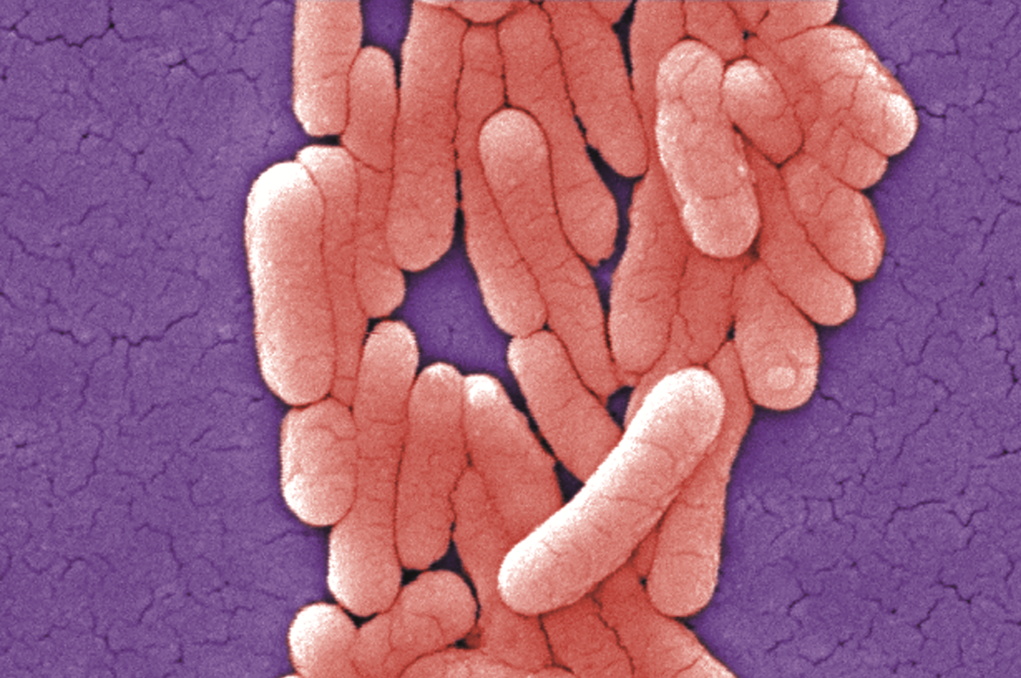 Cholesterol-lowering therapies could be used against typhoid - The ...