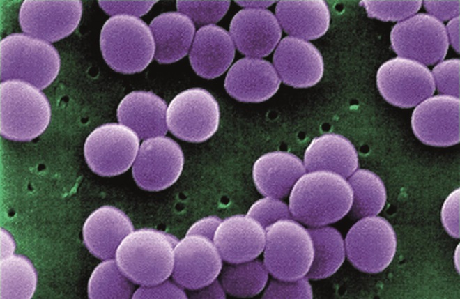 New antibiotic for hospital-acquired pneumonia now available in Europe ...