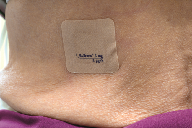 Transdermal buprenorphine poorly tolerated in people with dementia ...
