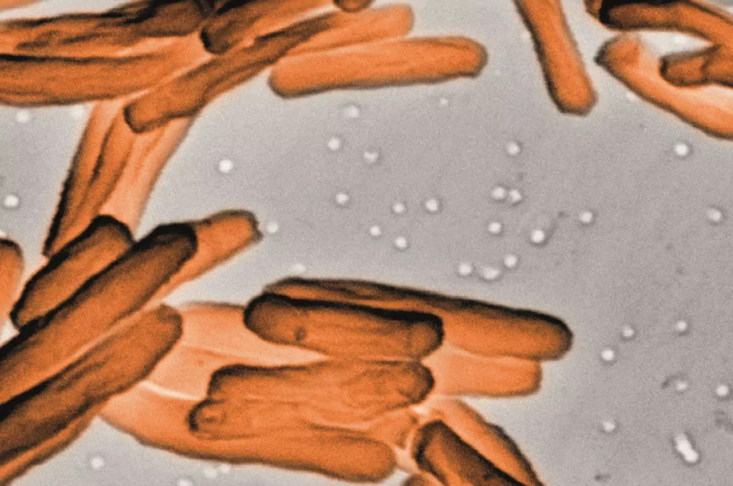 Virus-mimicking TB may offer therapeutic opportunities - The ...