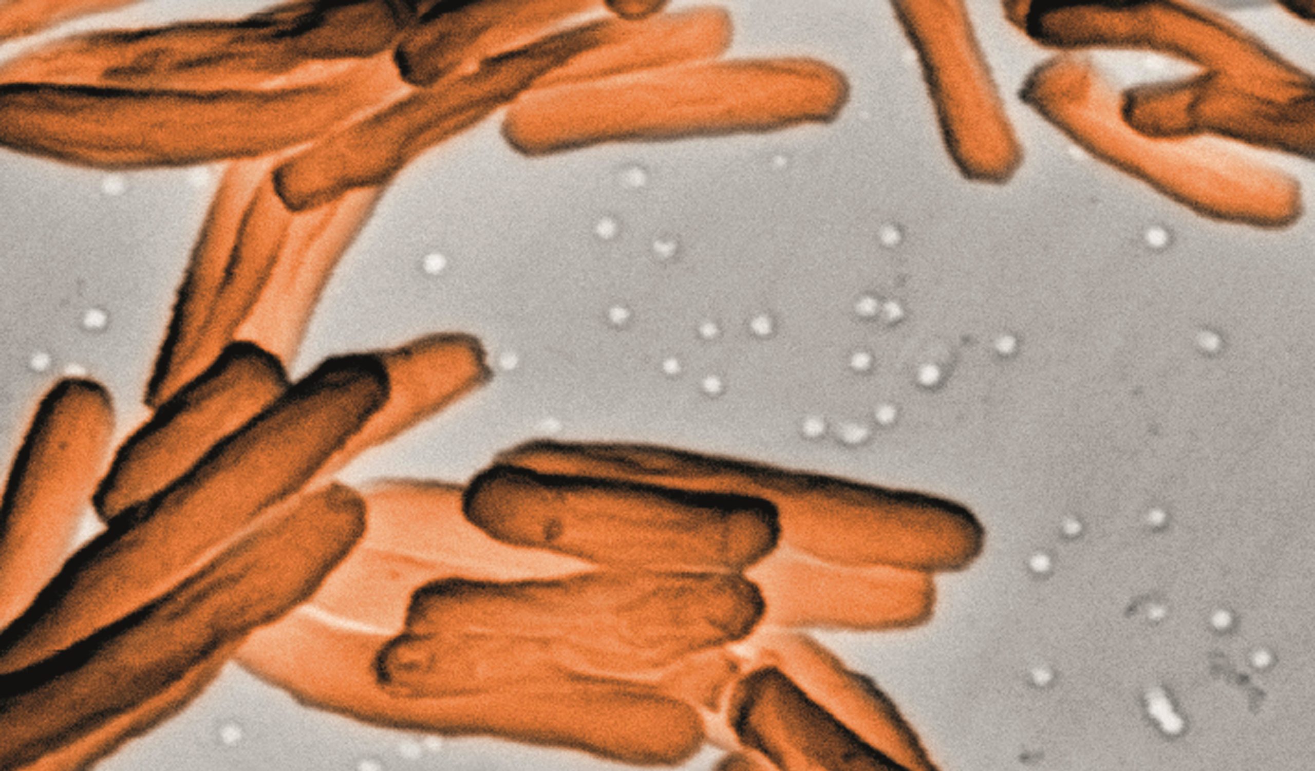 Virus-mimicking TB may offer therapeutic opportunities - The ...