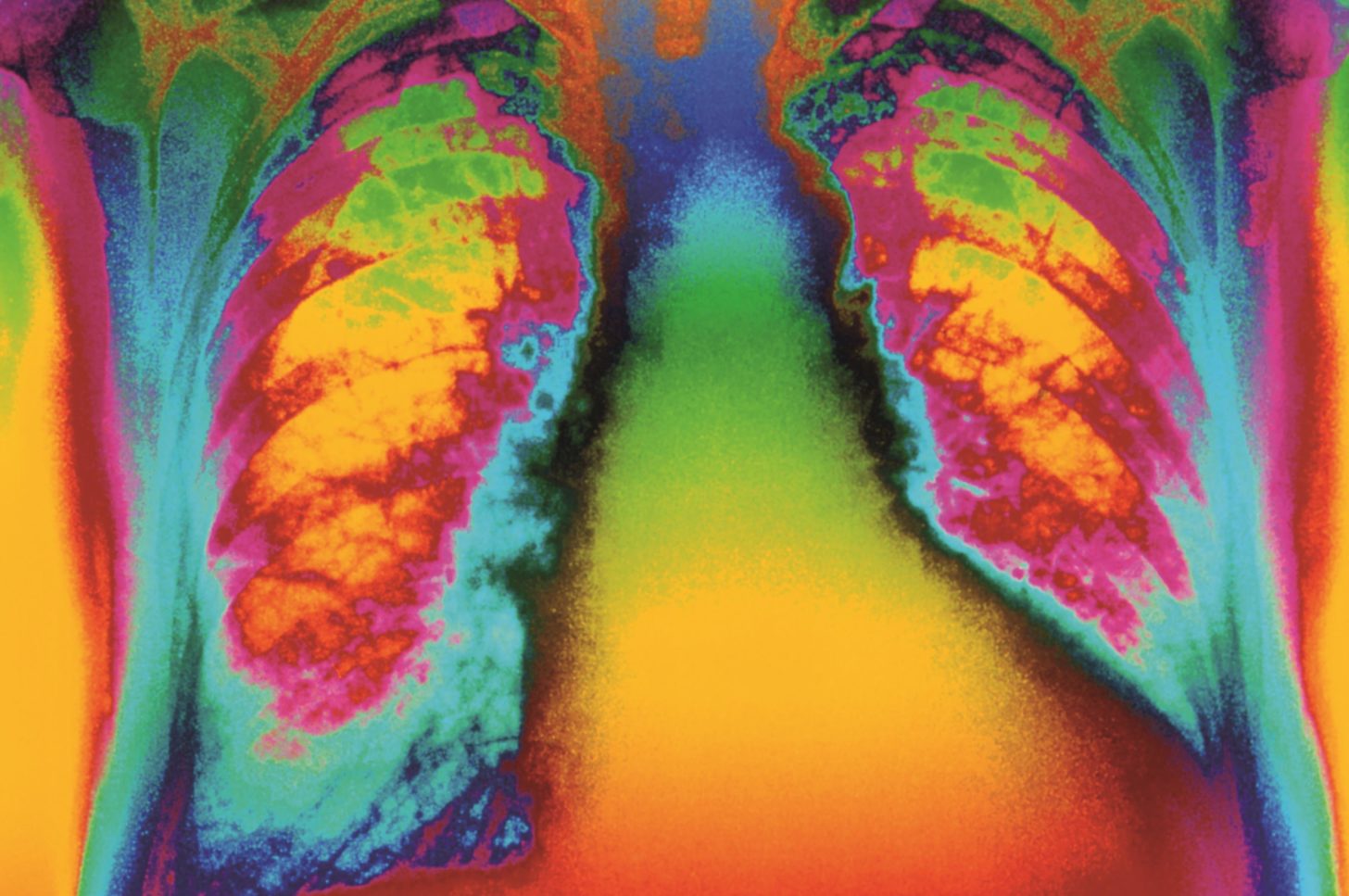 Heart failure treatment Entresto recommended for approval in Europe ...