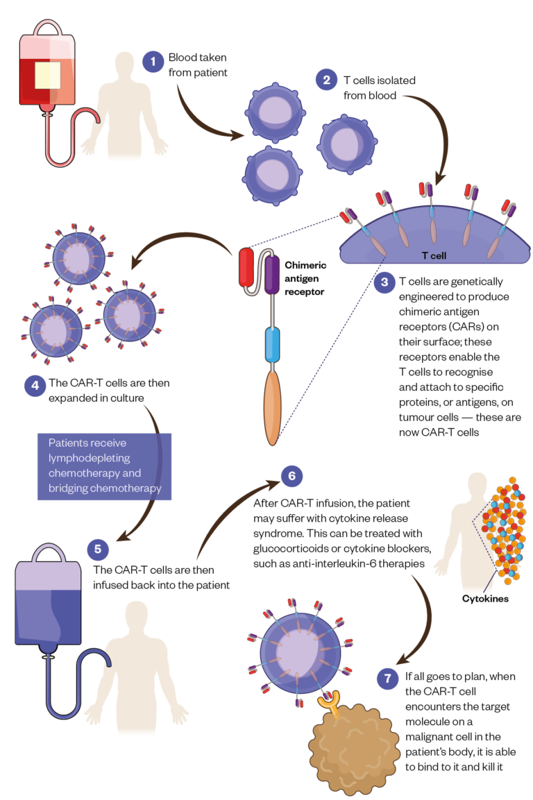 'Beyond our wildest dreams' – CAR-T therapies in multiple myeloma - The ...