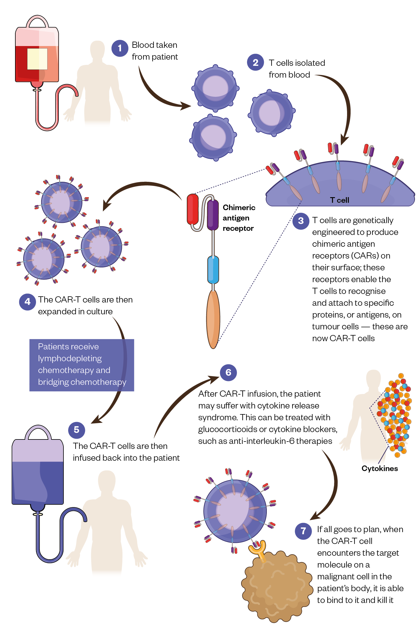 'Beyond our wildest dreams' – CAR-T therapies in multiple myeloma - The ...