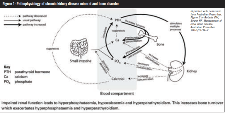 Chronic kidney disease: managing the complications - The Pharmaceutical ...