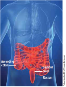 How to deal with constipation - The Pharmaceutical Journal