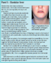Giving advice on sore throats - The Pharmaceutical Journal