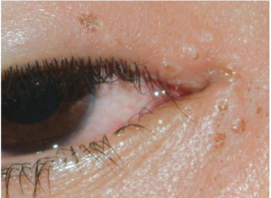 Ocular conditions from A to Z (i) - The Pharmaceutical Journal