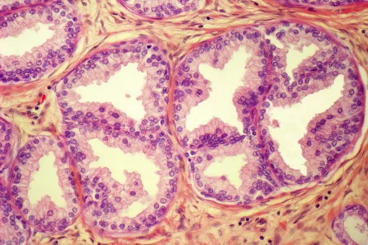 Thyrotoxicosis and hyperthyroidism: causes, diagnosis and management ...